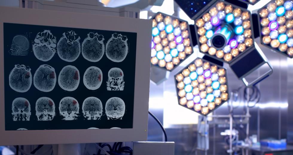 Sutter Health Unveils New Machine for Brain Surgery | Comstock's magazine